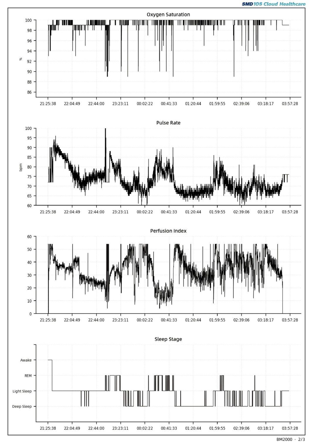 SMD100 เปิดตัว “SleepXpert Program” คัดกรองภาวะหยุดหายใจขณะหลับในผู้ป่วยเบาหวาน - มิติหุ้น | ชี้ ...